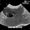 강아지 배가 딱딱해서 검사 받으러 갔어요 초음파 검사에서 담낭이 이상한 걸 발견했어요 강아지 담낭점액종 수술